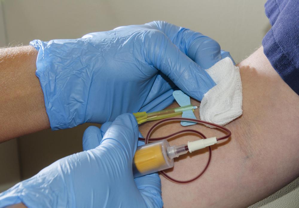 What Is Blood Testing with Pictures 