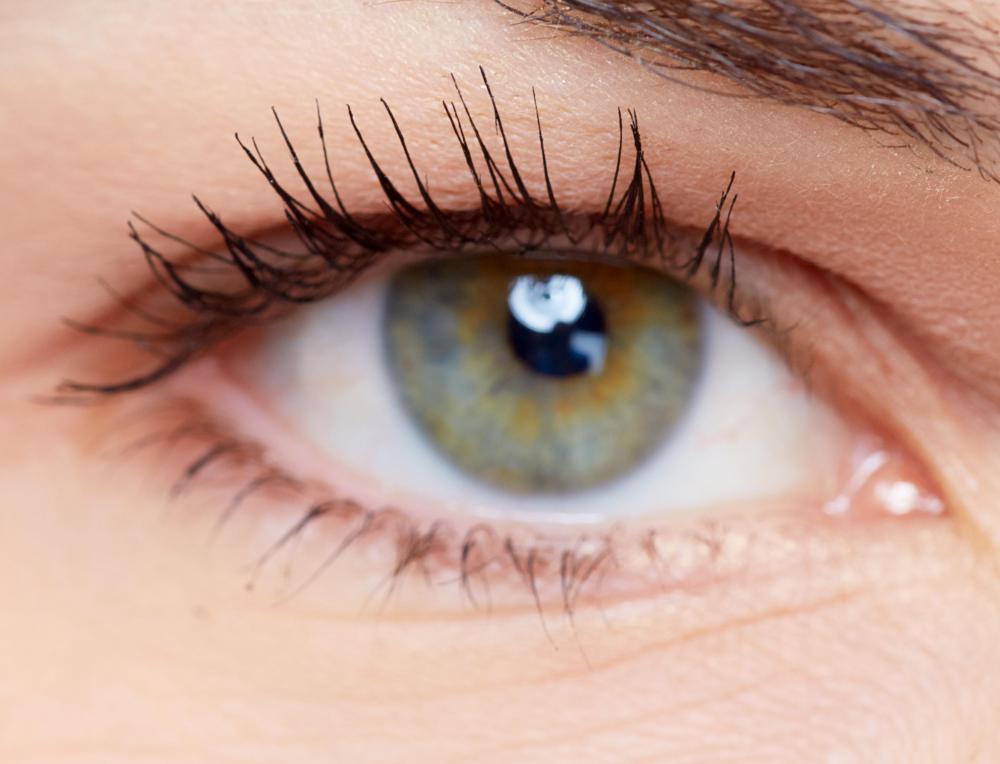 What Is Retinal Scarring with Pictures What Is Retinal Scarring with Pictures