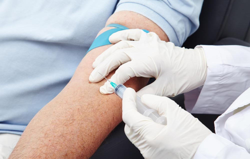 What Is Involved In A Progesterone Blood Test with Pictures What Is Involved In A Progesterone Blood Test with Pictures