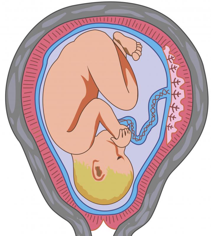 What Is Cephalic Version with Pictures 