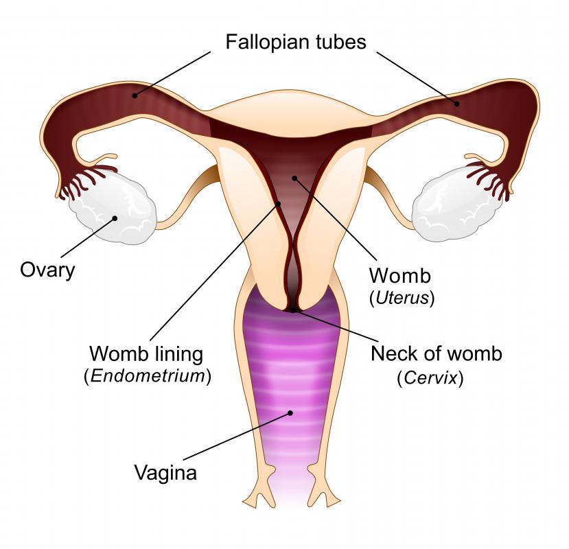 What Causes Inflammation Of The Cervix with Pictures 
