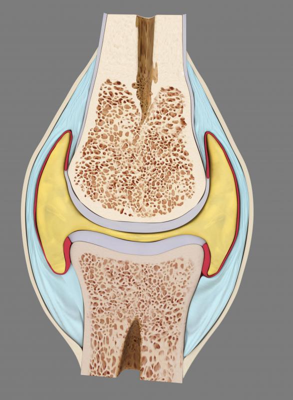 What Is Hyaline Cartilage with Pictures What Is Hyaline Cartilage with Pictures