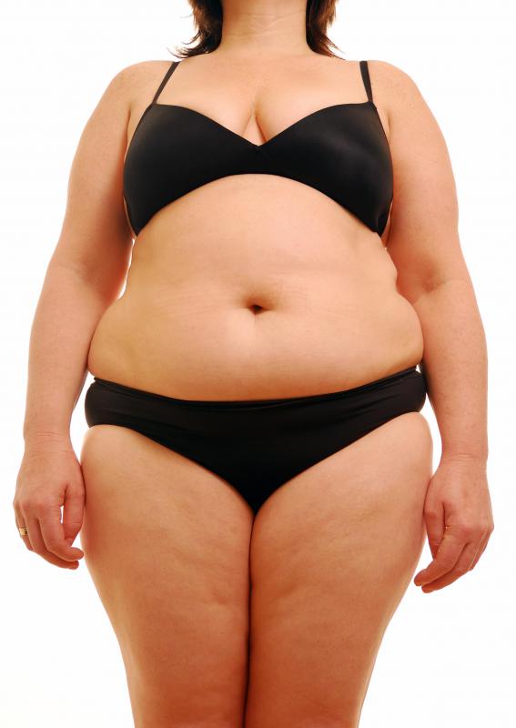 How Has Obesity Prevalence Changed Over Time with Pictures How Has Obesity Prevalence Changed Over Time with Pictures