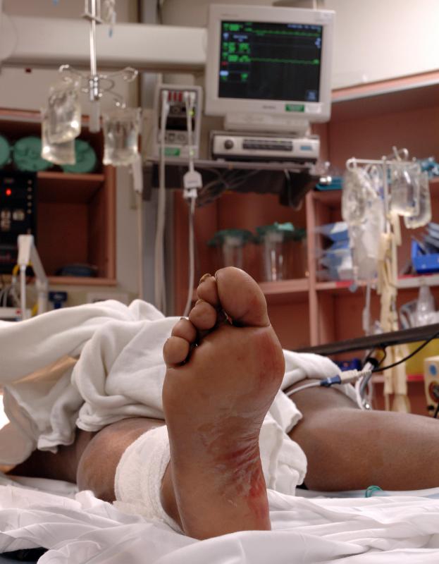 What Are The Different Types Of Triage Systems with Pictures 