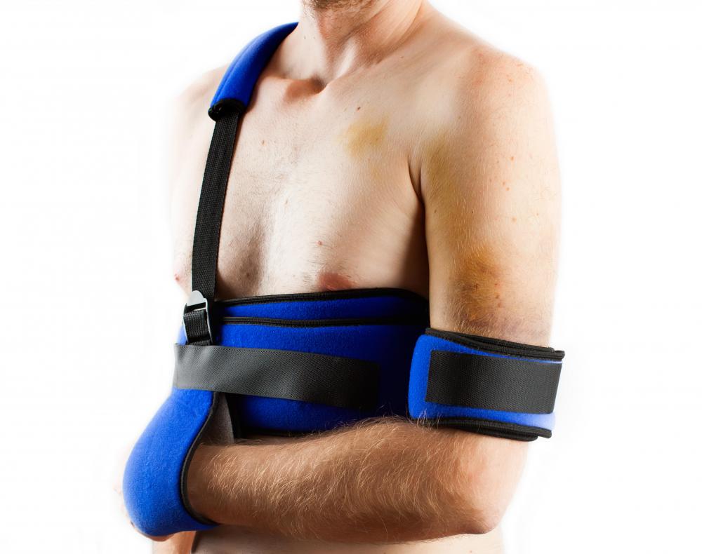 What Is The Acromioclavicular Joint with Pictures 