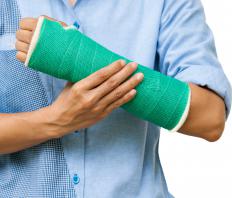 What Is a Triquetral Fracture? (with pictures)