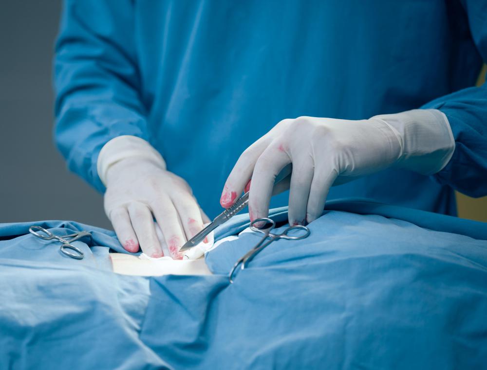 What Are The Different Types Of Scalpel Blades with Pictures What Are The Different Types Of Scalpel Blades with Pictures