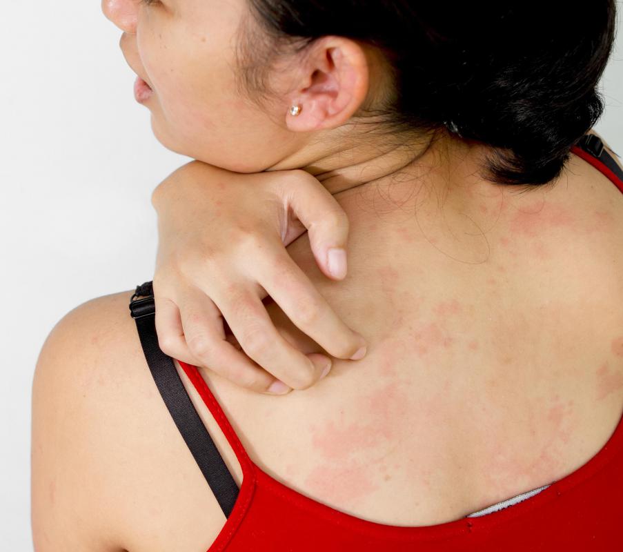 What Is The Difference Between Lupus And Fibromyalgia What Is The Difference Between Lupus And Fibromyalgia